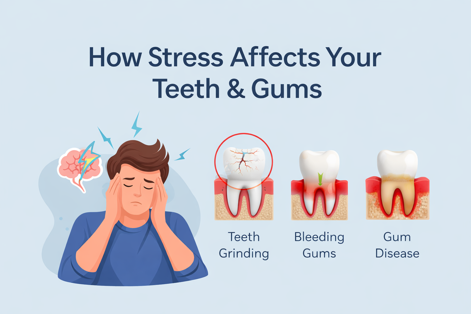 How Stress Affects Your Teeth & Gums | Ekdantam Clinic